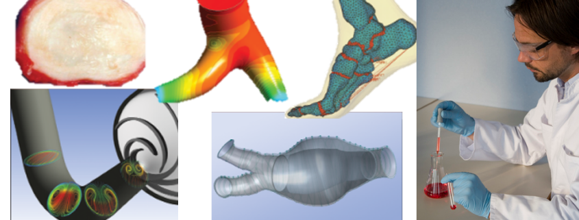 Medical Device Simulation For Reliability with ANSYS